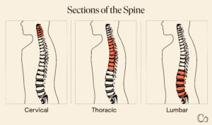 The Ultimate Guide To Artificial Disc Replacement Surgery - Commons Clinic