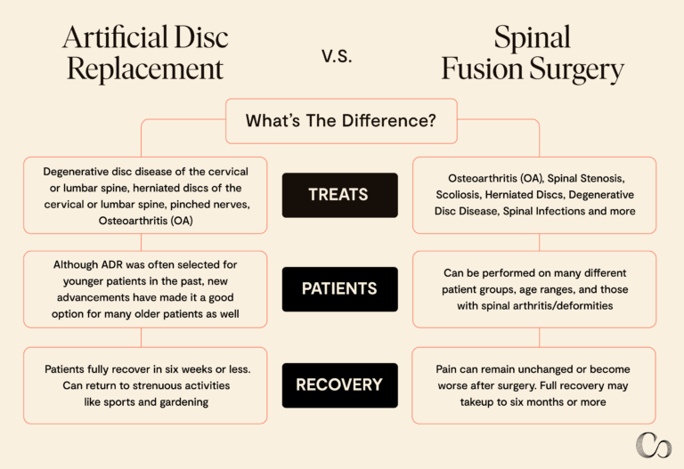 The Ultimate Guide To Artificial Disc Replacement Surgery - Commons Clinic