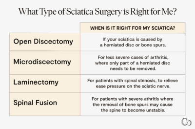 Sciatica Surgery 101: A Guide to Sciatica Surgery - Commons Clinic