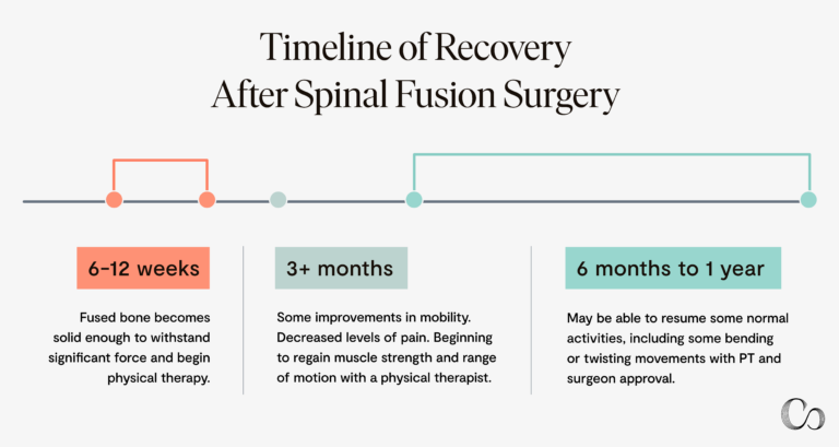 Spinal Fusion 101: Understanding Spinal Fusion Surgery - Commons Clinic