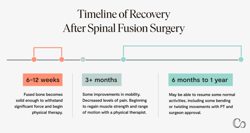 Spinal Fusion 101: Understanding Spinal Fusion Surgery - Commons Clinic