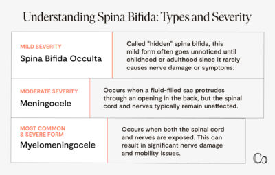 Spina Bifida in Adults 101: Types, Tests and Treatments - Commons Clinic