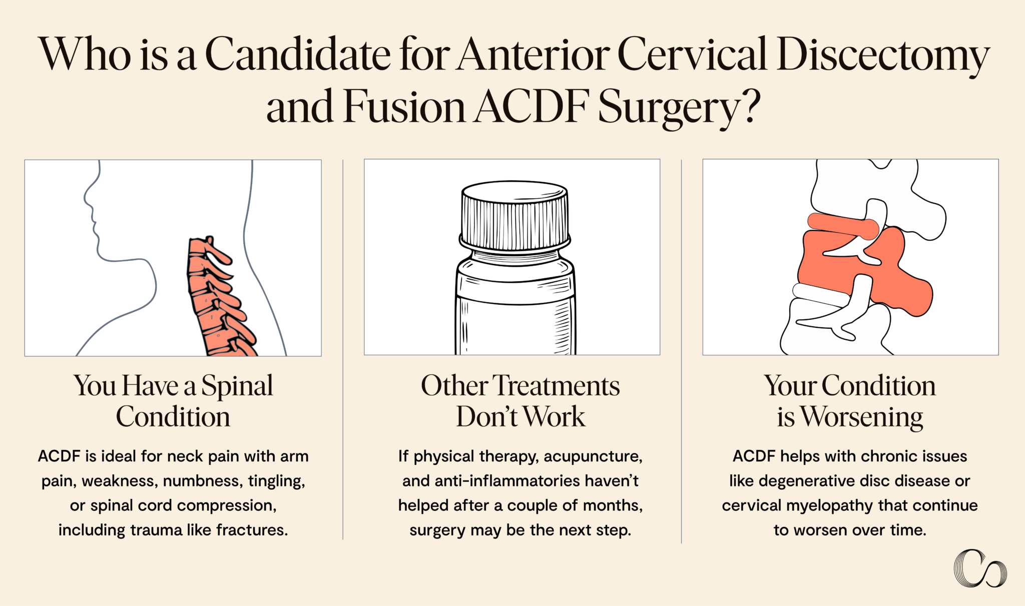 Anterior Cervical Discectomy & Fusion (ACDF) for Neck Pain - Commons Clinic
