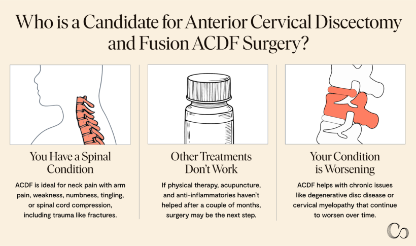 Anterior Cervical Discectomy & Fusion (ACDF) for Neck Pain - Commons Clinic
