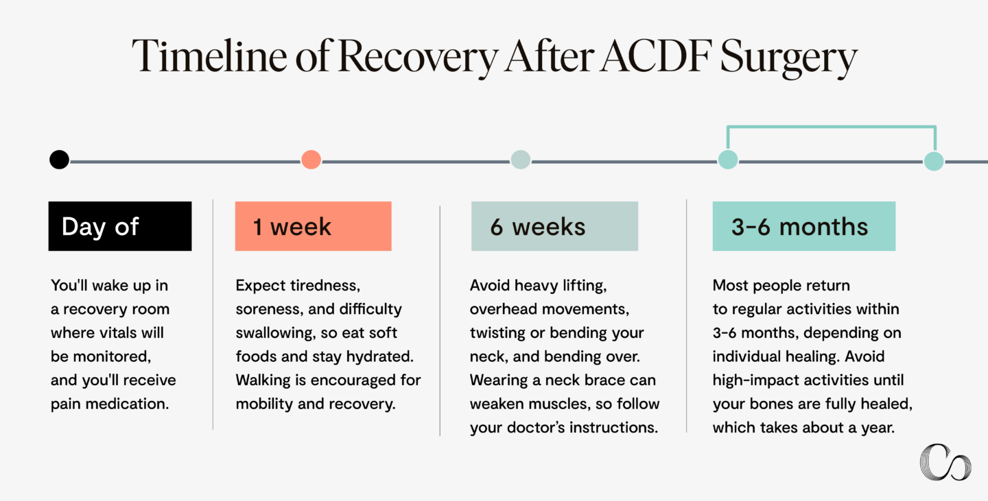 Anterior Cervical Discectomy & Fusion (ACDF) for Neck Pain - Commons Clinic