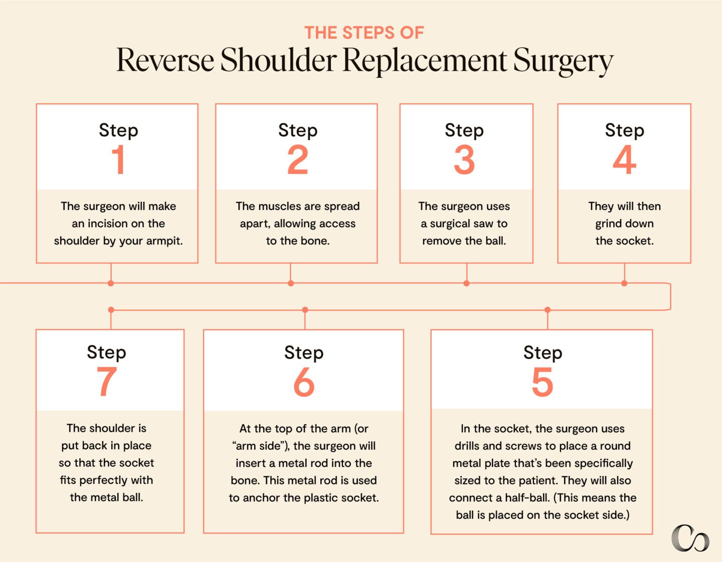 Reverse Shoulder Replacement Surgery 101: In-depth Guide - Commons Clinic