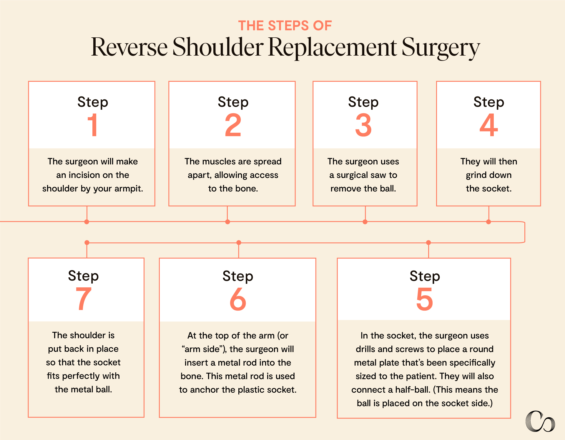 Reverse Shoulder Replacement Surgery 101: In-depth Guide - Commons Clinic