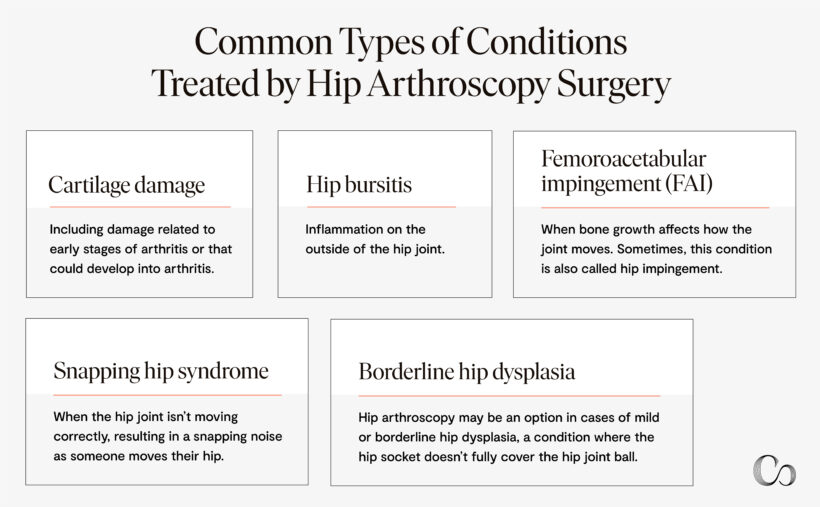 Hip Arthroscopy 101 — Procedure and Recovery Guide - Commons Clinic