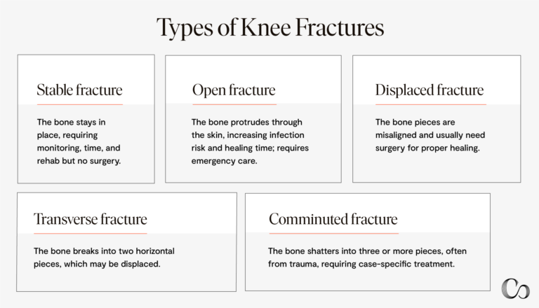 Knee Fracture 101: Types, Symptoms, Treatment, and Surgery - Commons Clinic