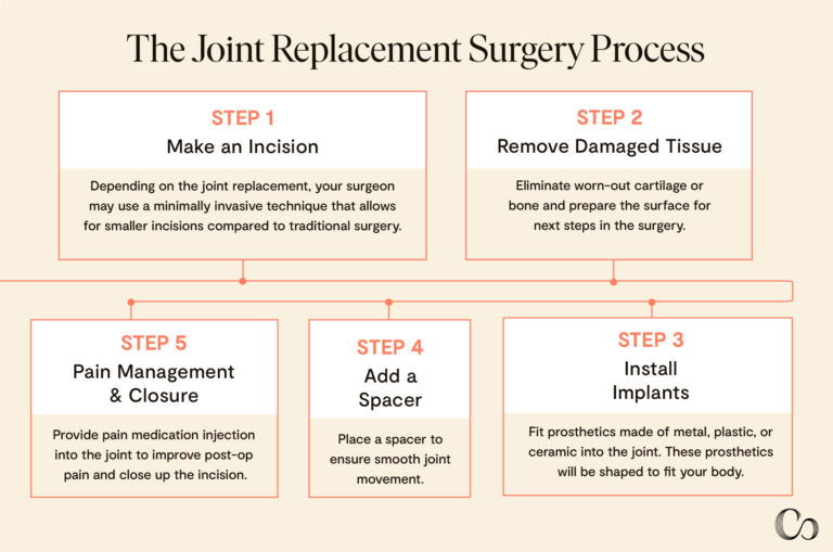 Total Joint Replacement Surgery 101 - Commons Clinic