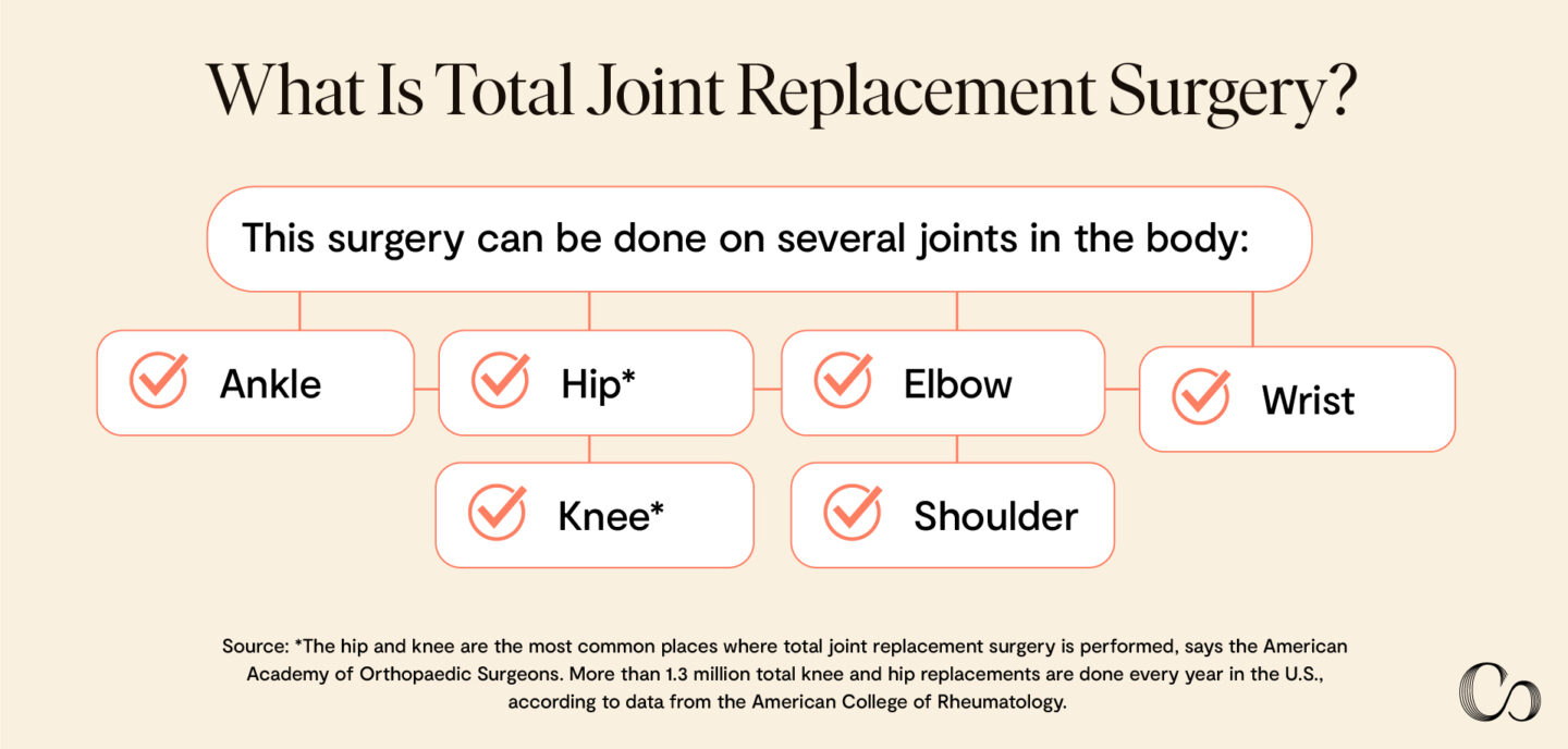 Total Joint Replacement Surgery 101 - Commons Clinic